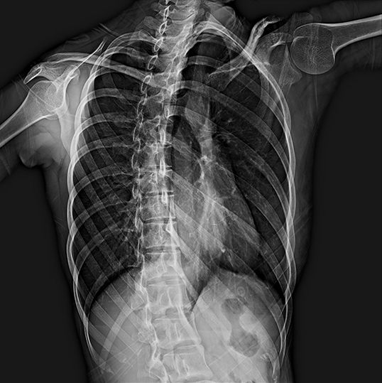 Línea de Rayos X – Bio Scan