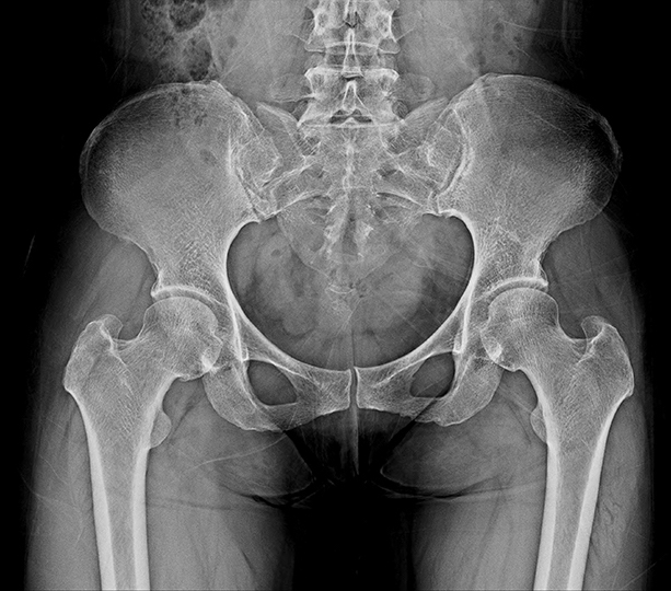 Línea de Rayos X – Bio Scan